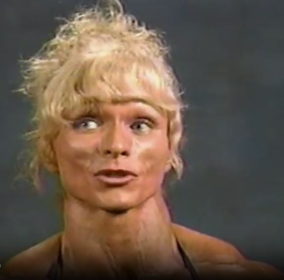muscular necks
